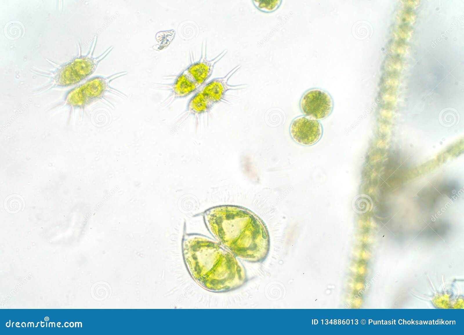 Freshwater Aquatic Plankton Under Microscope View Stock Image - Image ...