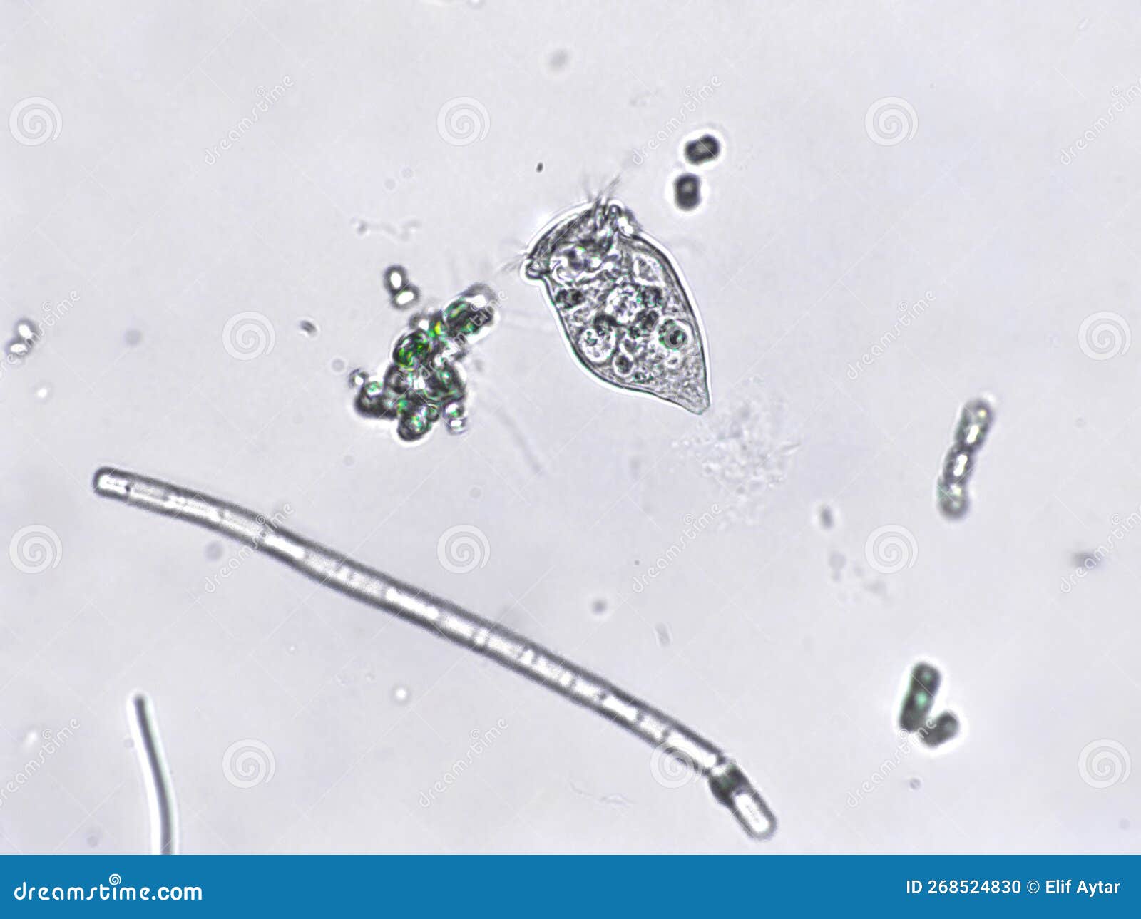 Freshwater Zooplankton Rotifer Or Rotifera Euchlanis Royalty-Free Stock ...