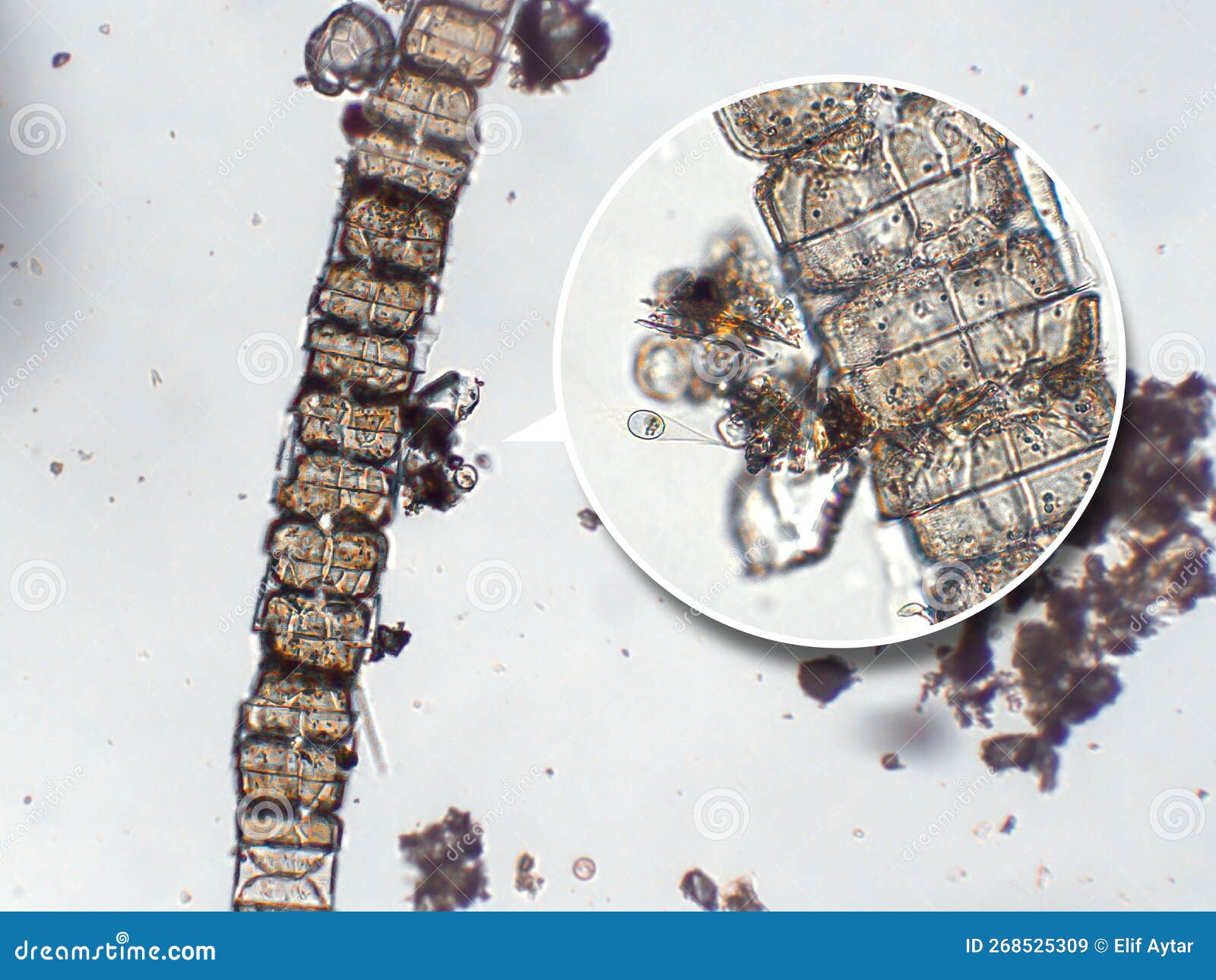 Freshwater Zooplankton Copepod Nauplius Larva. Microscopic Crustacean ...