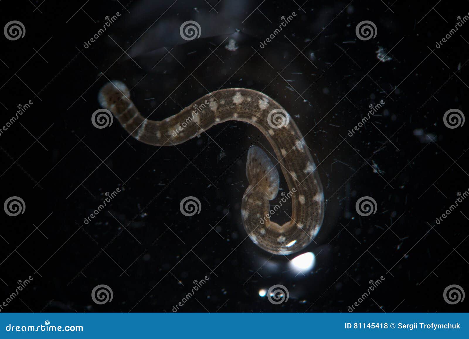 Freshwater Leech Piscicola Geometra by Microscope. Parasite, Disease of ...