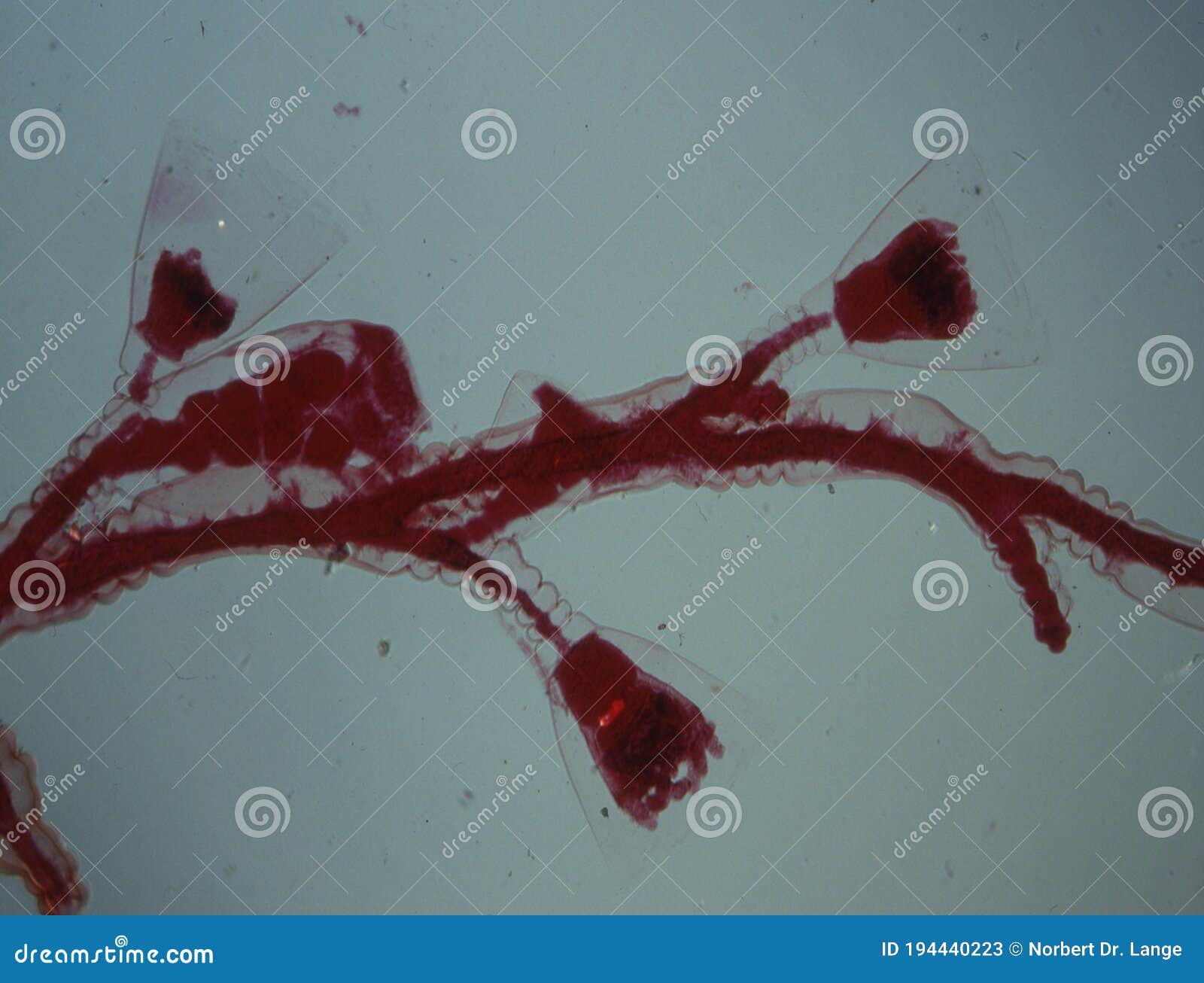 Freshwater Polyps Under The Microscope Royalty-Free Stock Image ...