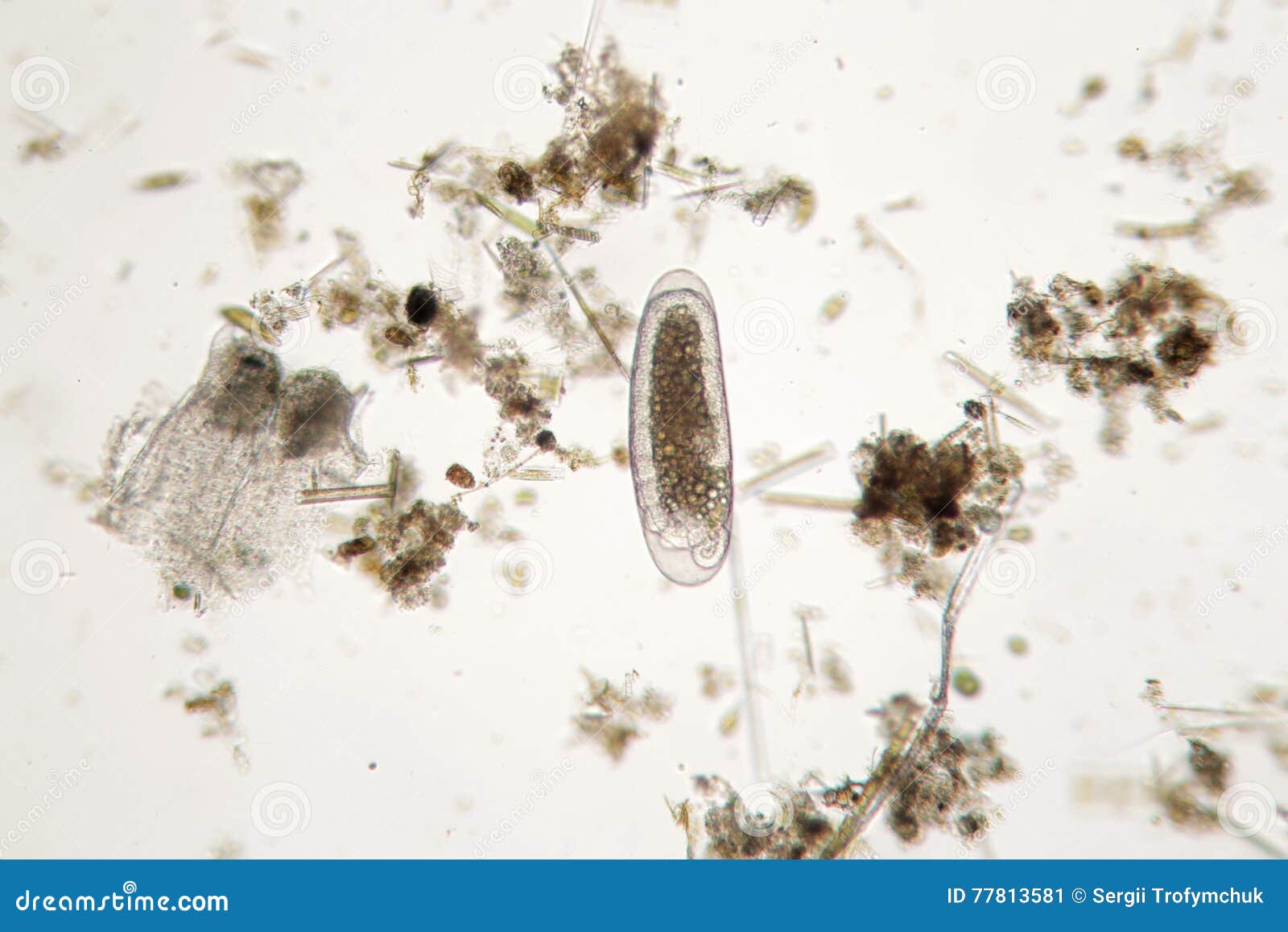 Freshwater Zooplankton Copepod Nauplius Larva. Microscopic Crustacean ...
