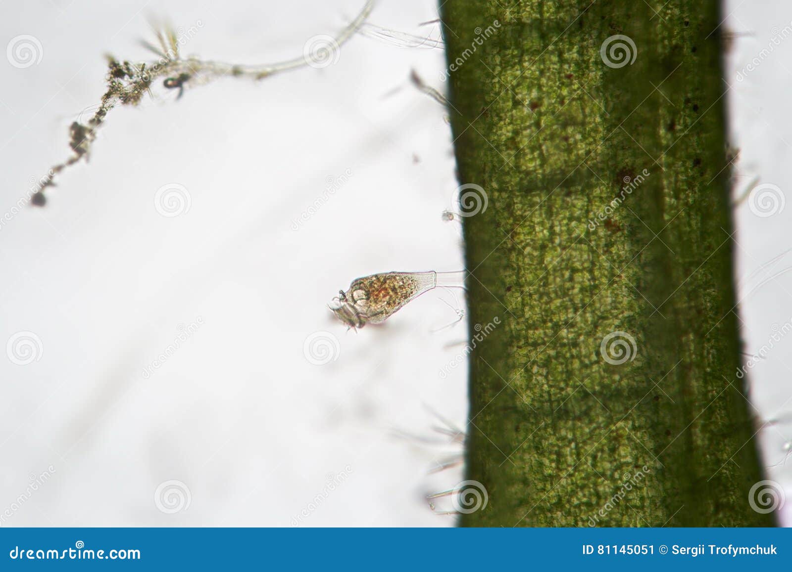 Ciliophora Ciliata Vorticella Colonia In Freshwater. Microorganisms By ...