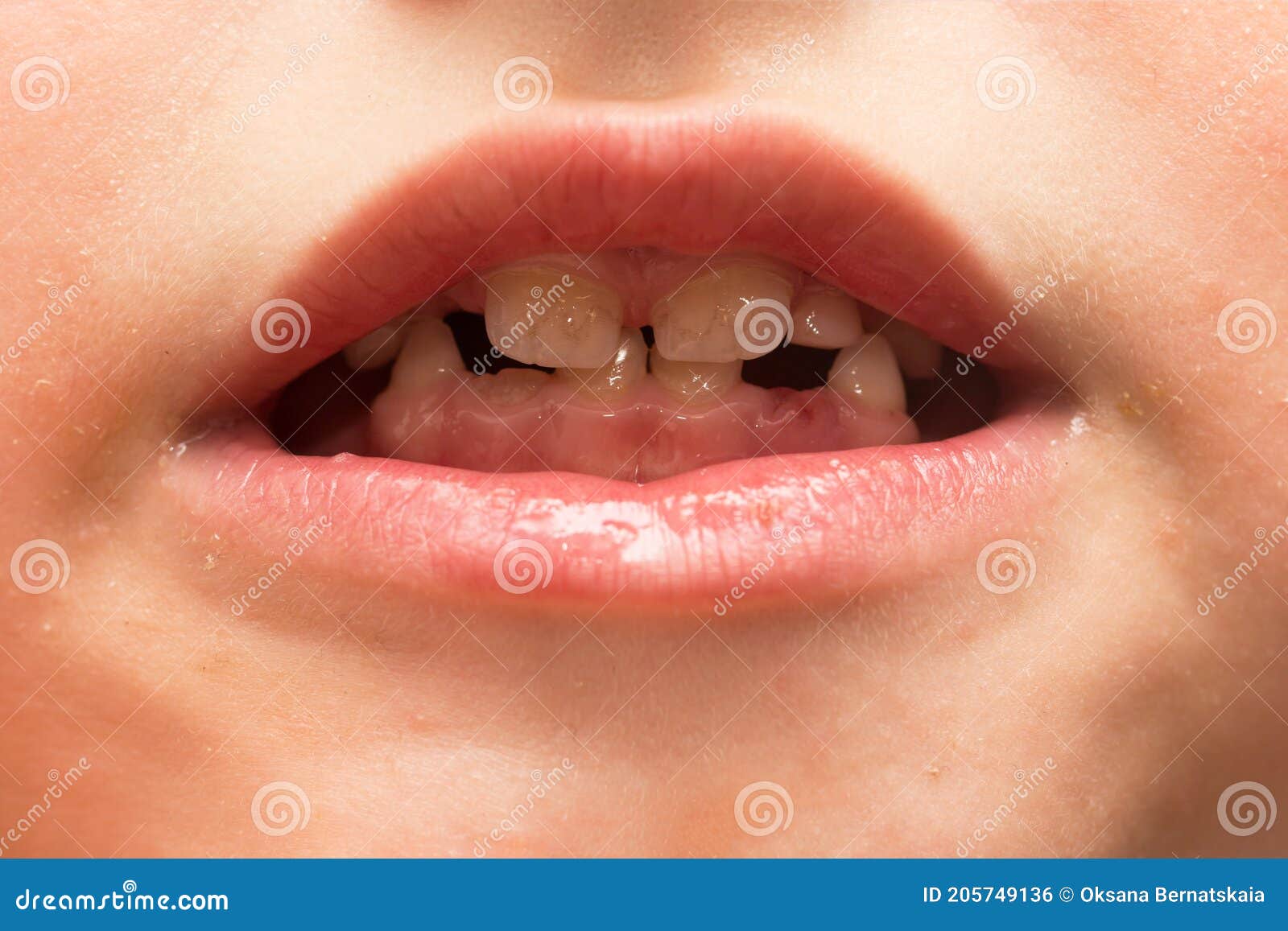 Fria Boca Sem Dentes Como Fundo Foto de Stock - Imagem de pequeno ...
