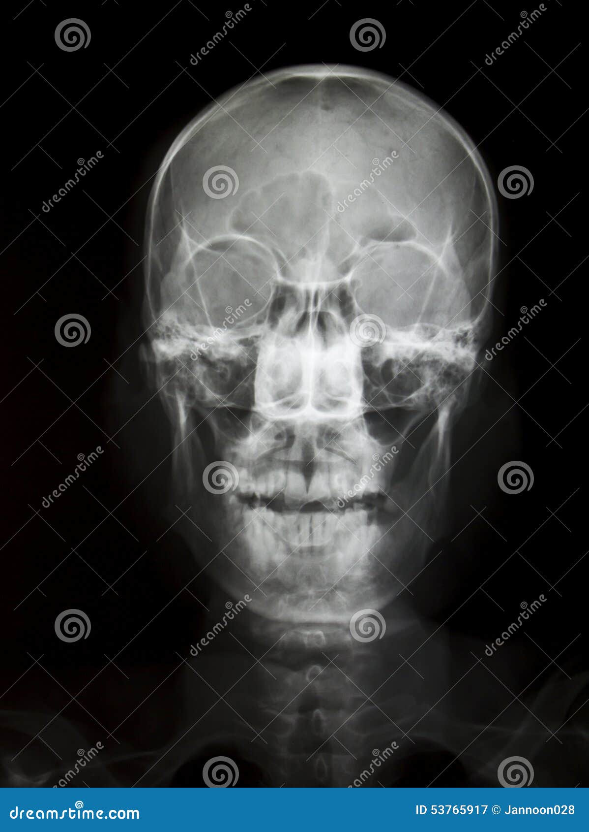 Front face skull x-ray stock image. Image of dark, segment - 53765917