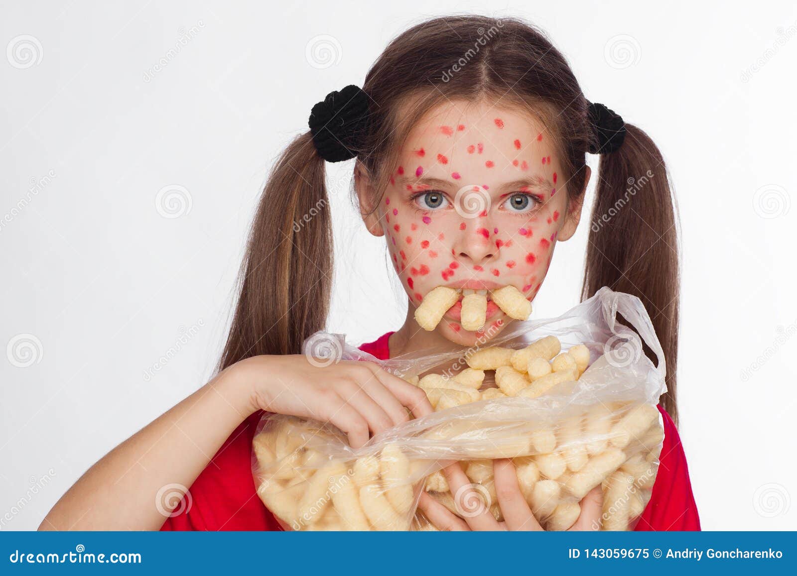Front View of a Girl with a Problem Skin Rash Who Eats Corn Sticks ...