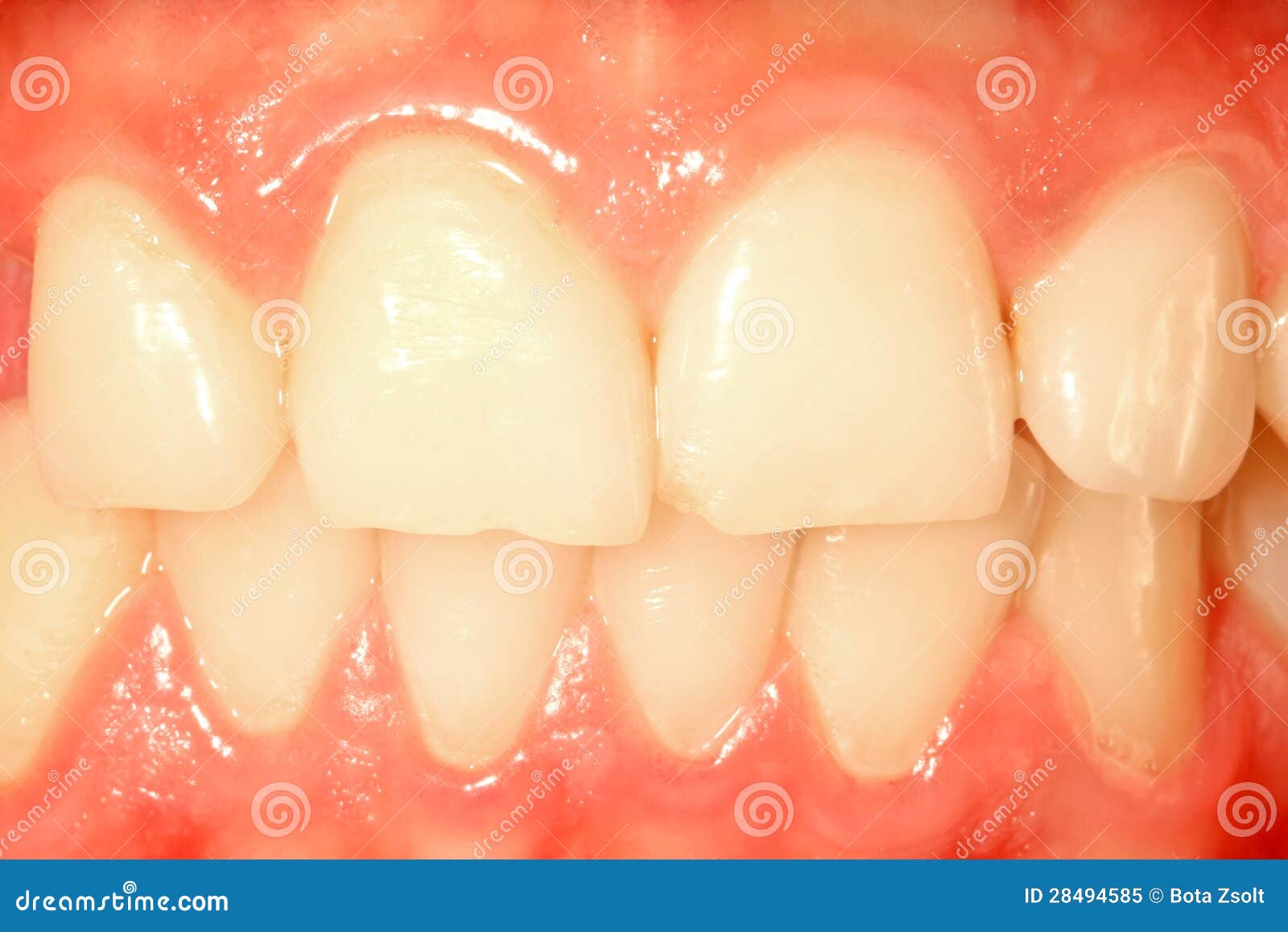 Frontal teeth stock image. Image of molar, medical, tooth - 28494585