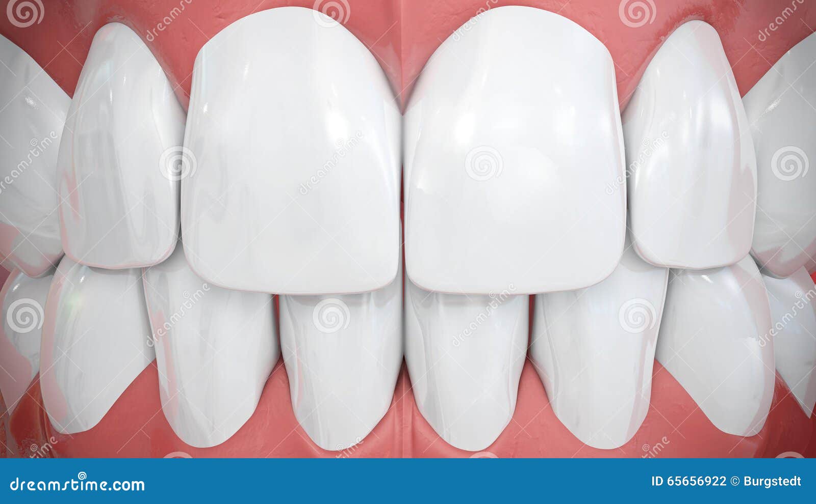 Frontal View on Sparkling White Anterior Teeth Stock Photo - Image of ...