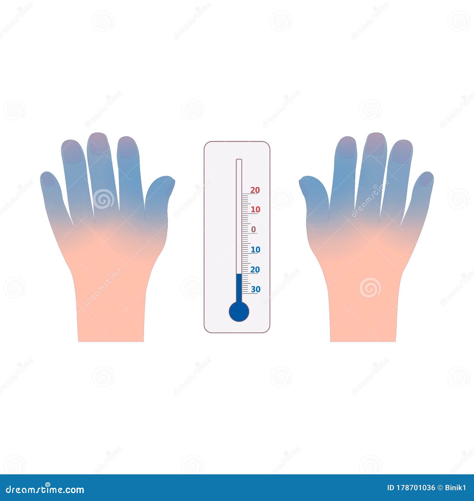 Frostbite Hands and Thermometer Icon Vector Stock Vector - Illustration ...