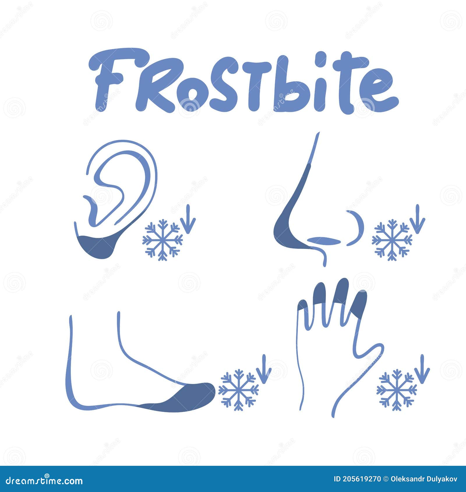 Frostbite Icons. Vector Linear Illustration Of Frozen Hand, Foot, Ear ...