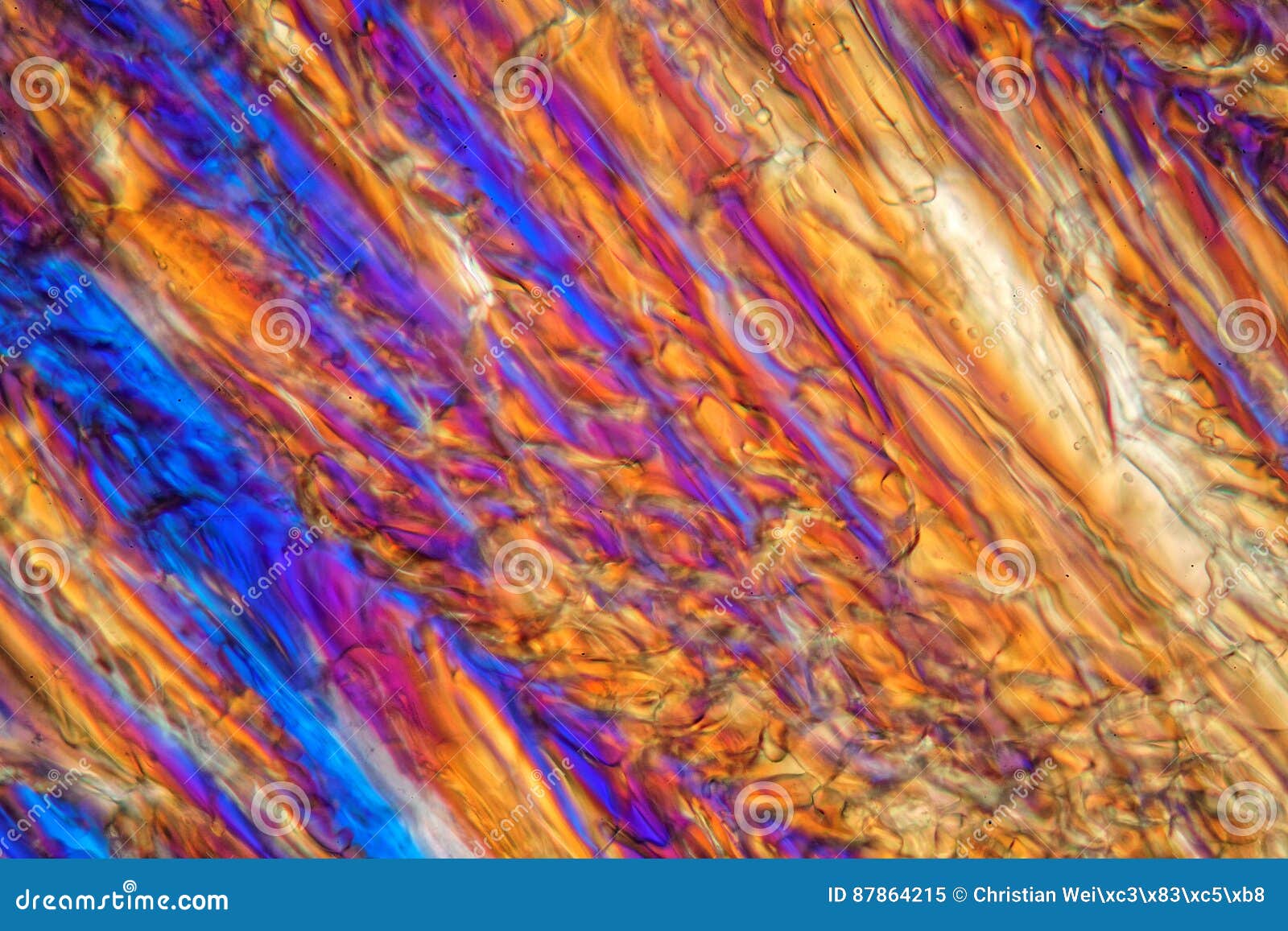 Frozen Apple Juice Under A Microscope. Royalty-Free Stock Photography ...