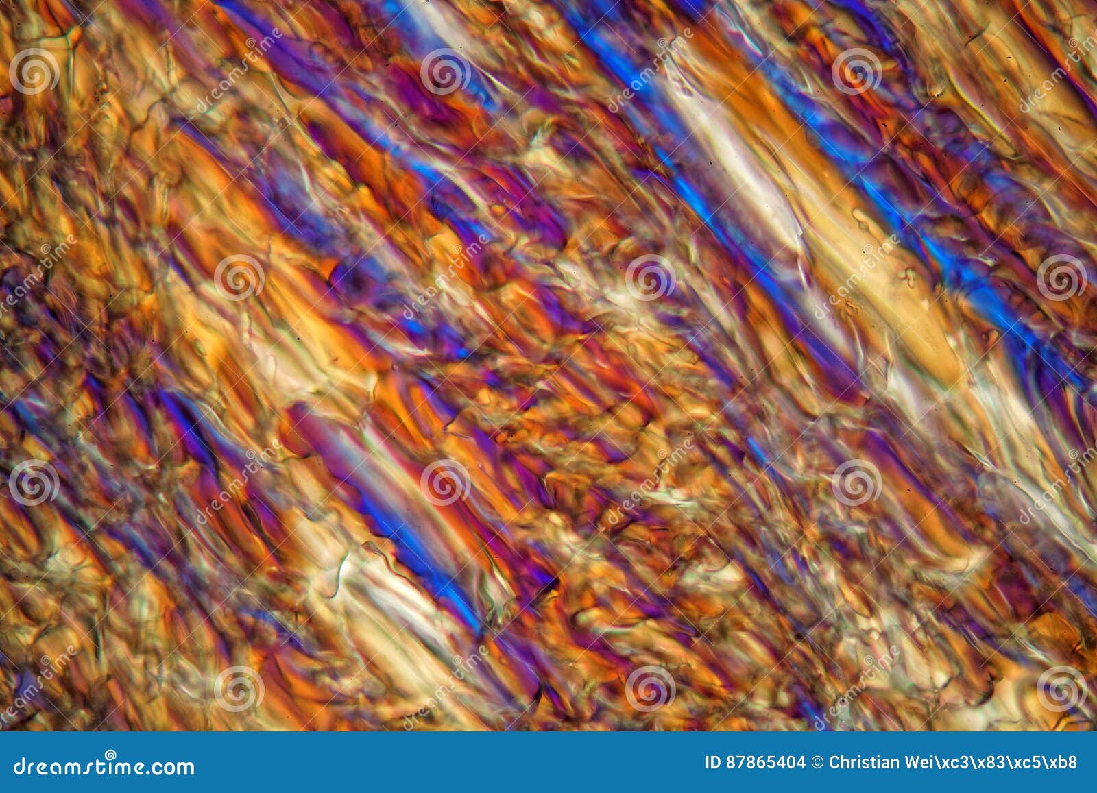 Frozen Apple Juice Under A Microscope. Royalty-Free Stock Photography ...