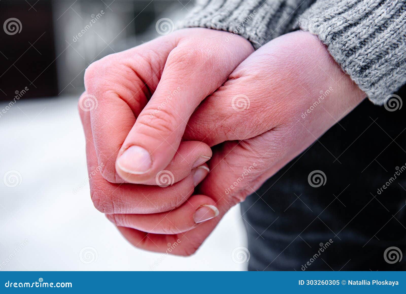 Frozen Blue Hands in Winter Cold. Stock Image - Image of cold, mittens ...