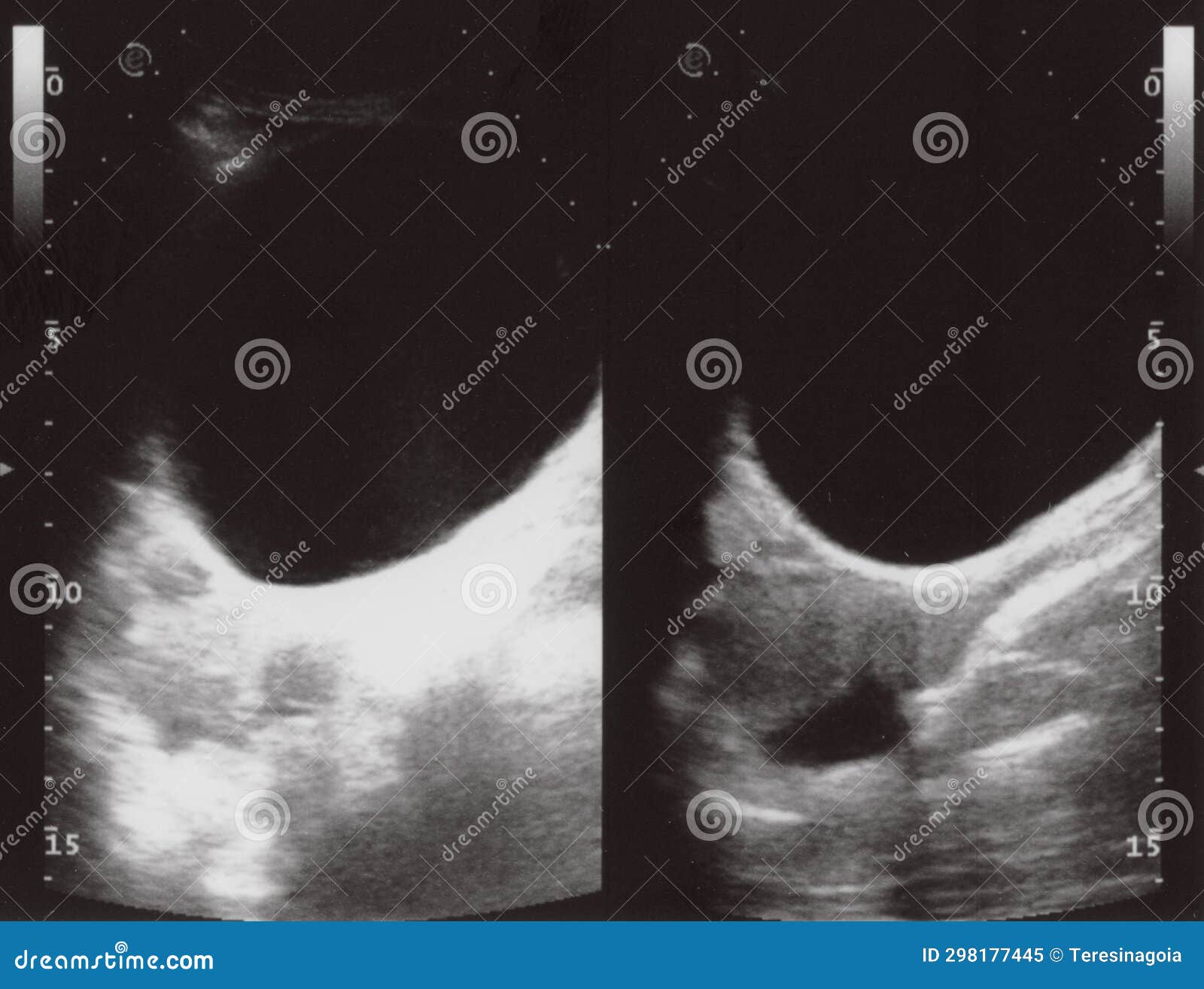 Full Abdomen Ultrasound Sonogram Stock Image - Image of pharmacy ...