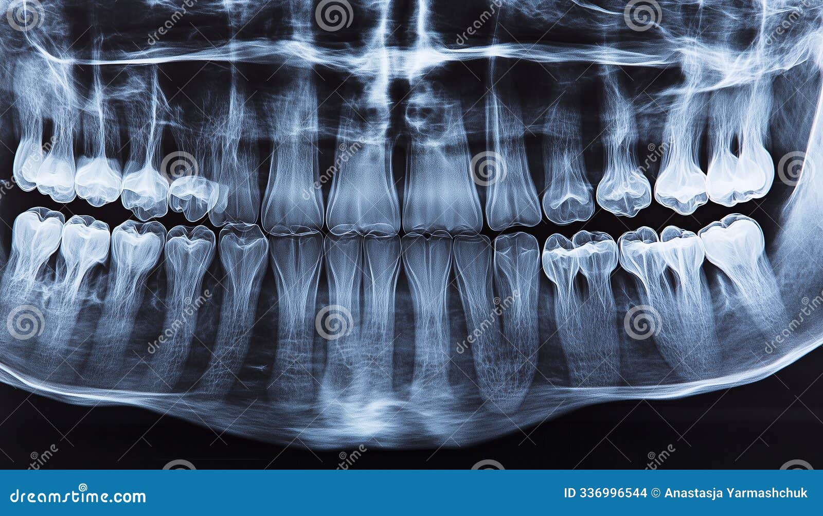 A Full Panoramic Image Showing All Teeth of the Upper and Lower Jaws ...