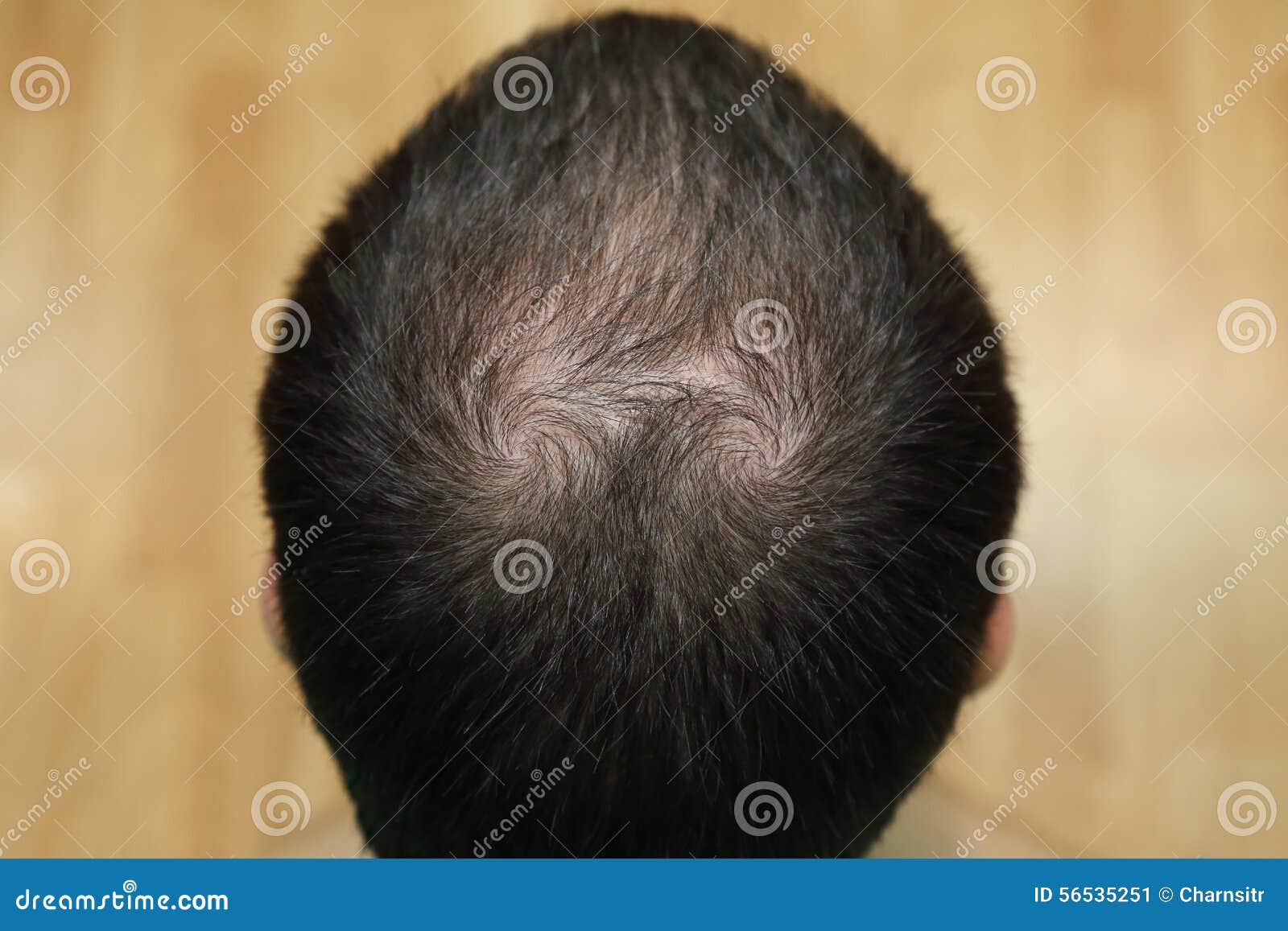 Fundo da cabeça calva imagem de stock. Imagem de adulto - 56535251