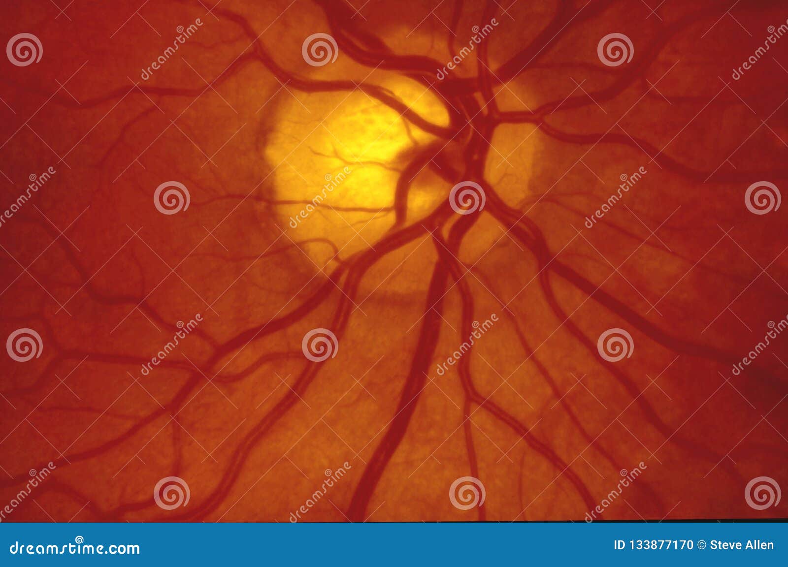 X-ray Normal Human Foot . Lateral View . Invert Color Style Royalty ...