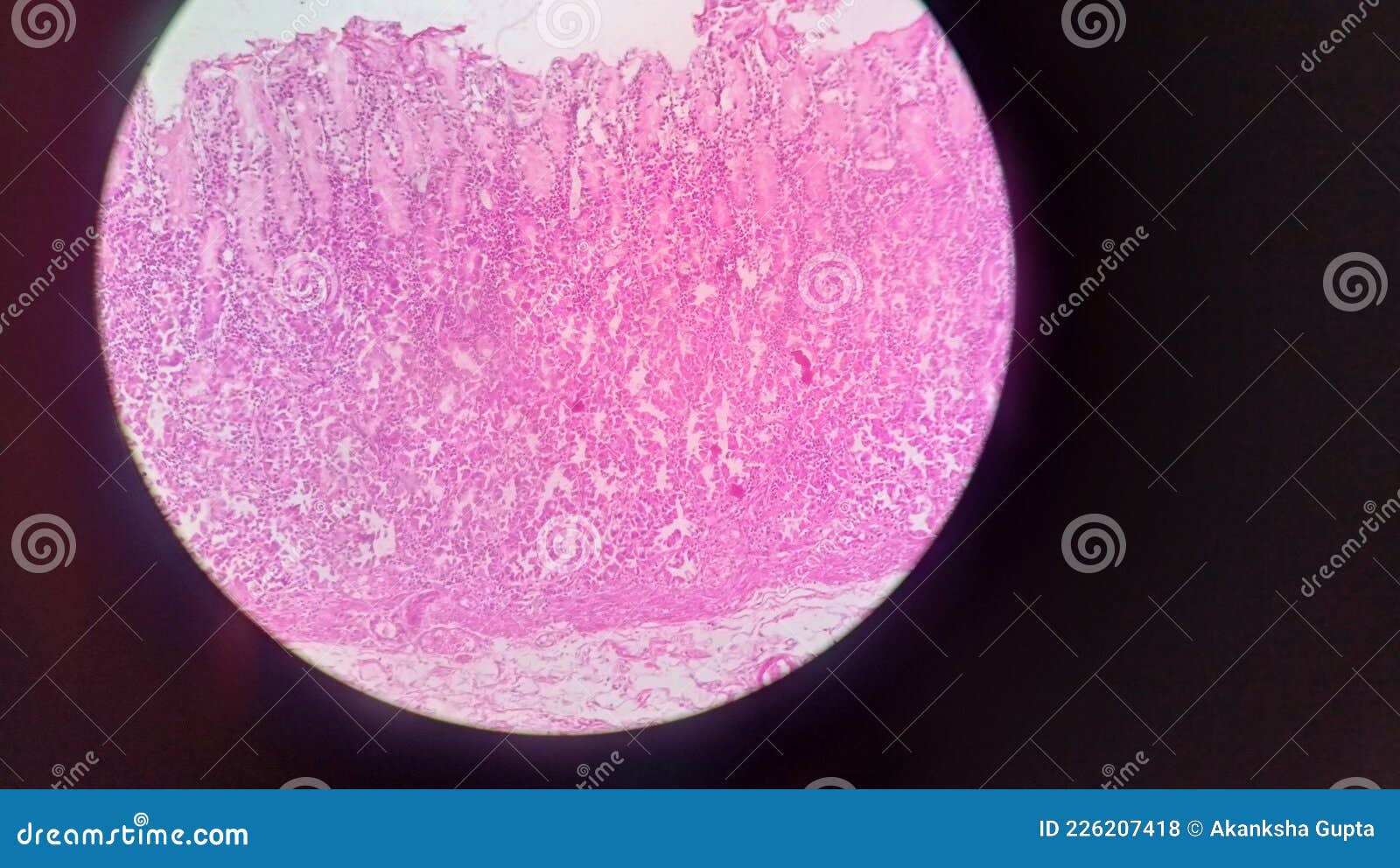 FUNDUS VIEW UNDER MICROSCOPE Stock Photo - Image of organ, heart: 226207418