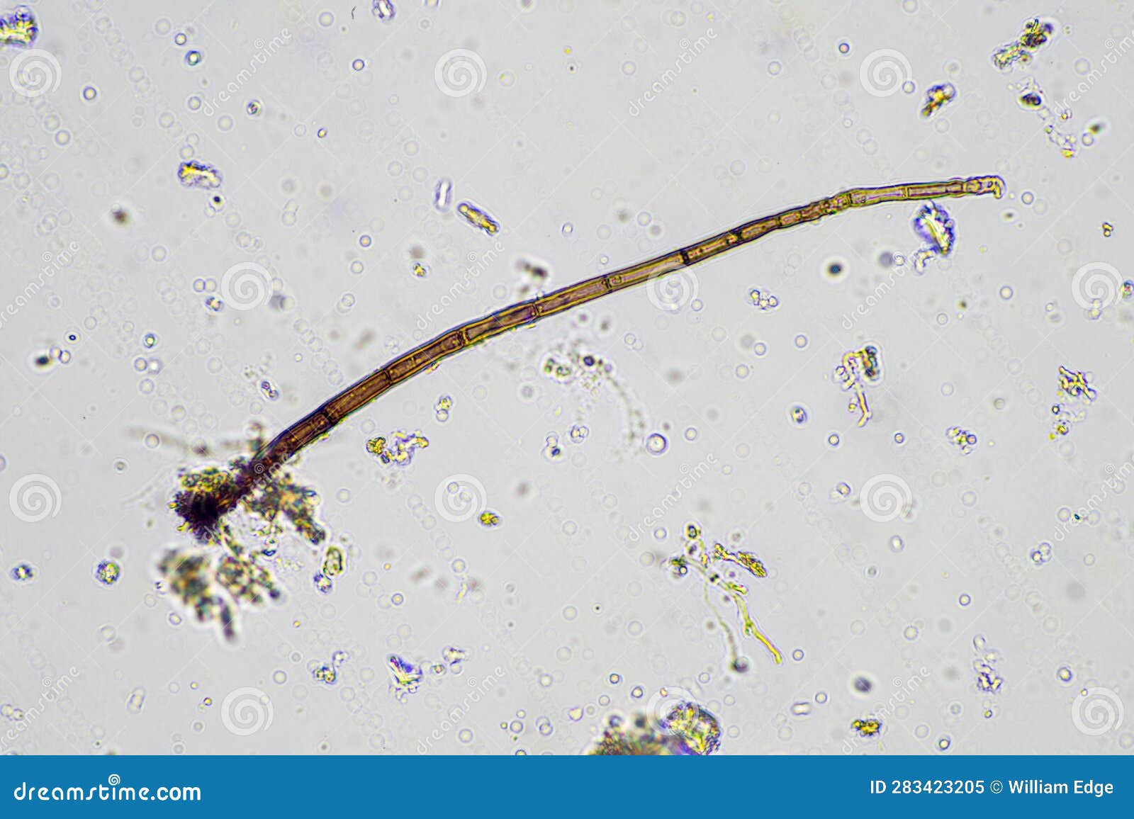 Fungal Hyphae Under the Microscope Stock Image - Image of epithelial ...