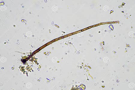 Fungal Hyphae Under the Microscope Stock Image - Image of epithelial ...