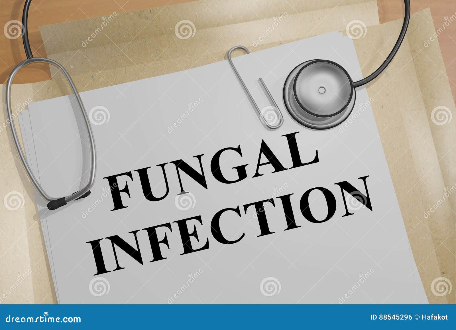 Fungal Infection - Medical Concept Stock Illustration - Illustration of ...