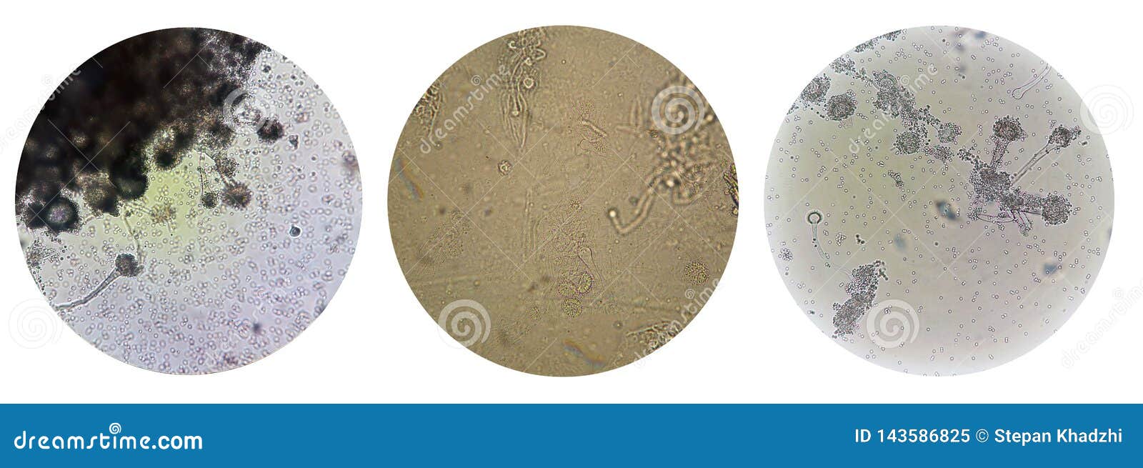 Fungi Aspergillus Microscopic View Sexually Transmitted Disease STD ...