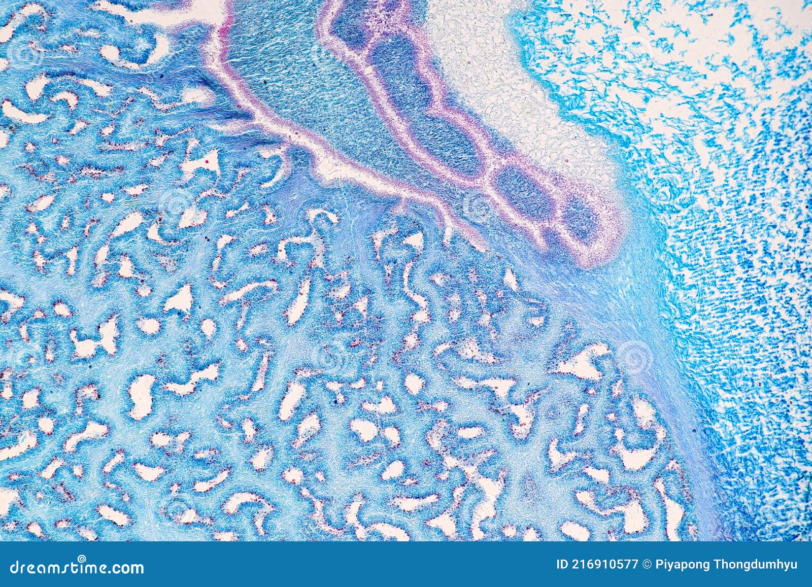 Fungi Living In Wood As A Group, Are Polyphyletic Under The Microscope ...