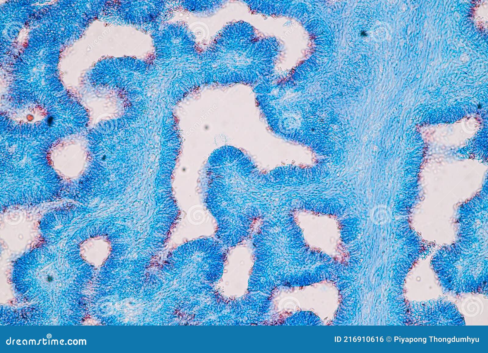 Fungi Living In Wood As A Group, Are Polyphyletic Under The Microscope ...