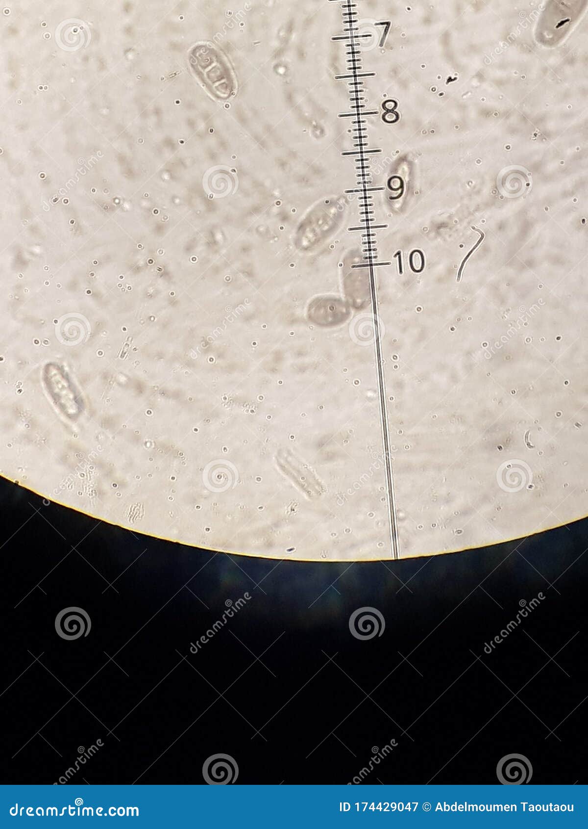 Fungi Spores Under Light Microscopy Stock Image - Image of conidie ...
