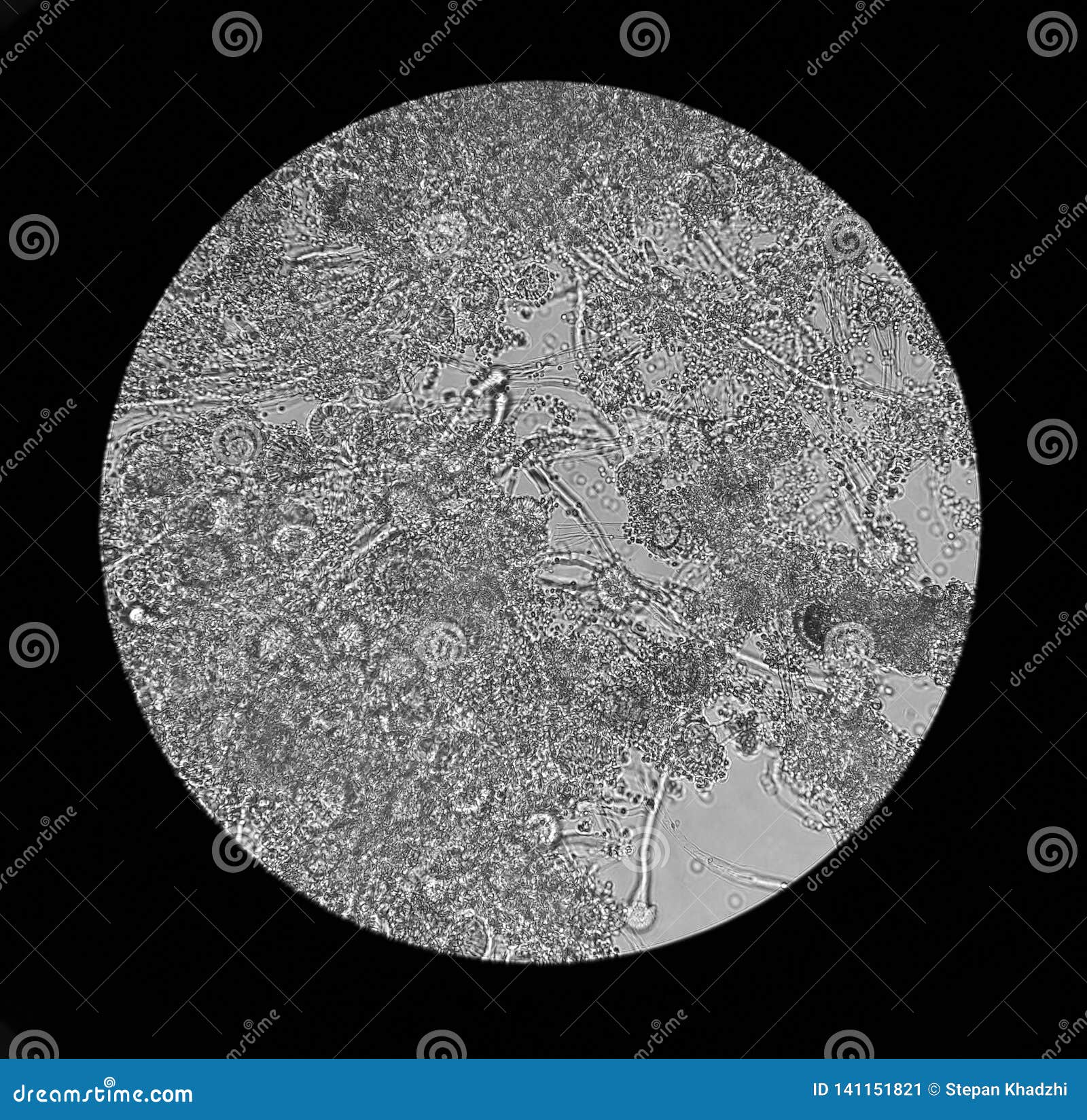 Fungi Under Microscopic View Aspergillus. Fungus Microbiology Stock ...
