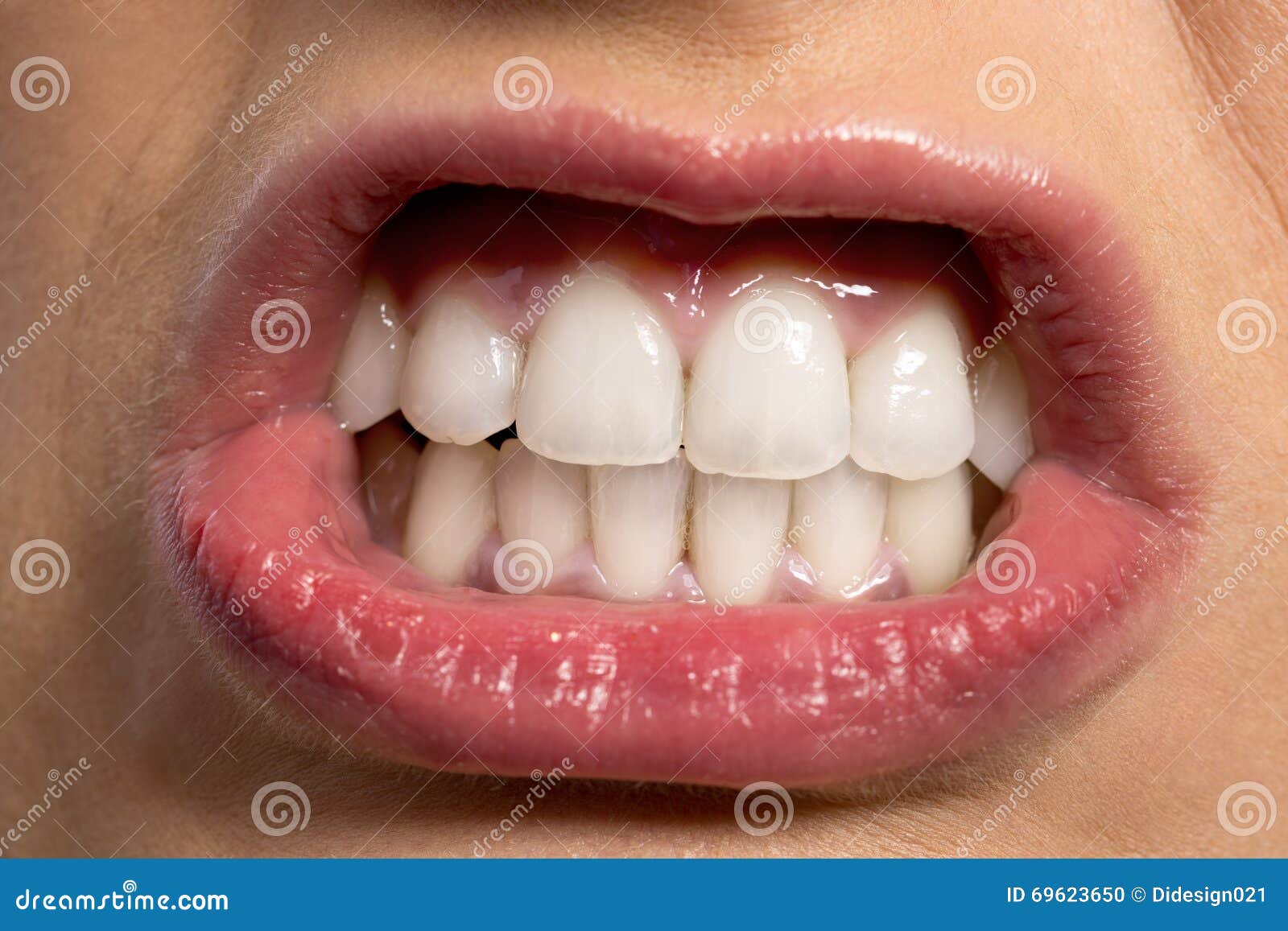 Funny Mouth with Beautiful White Teeth Stock Photo - Image of care ...
