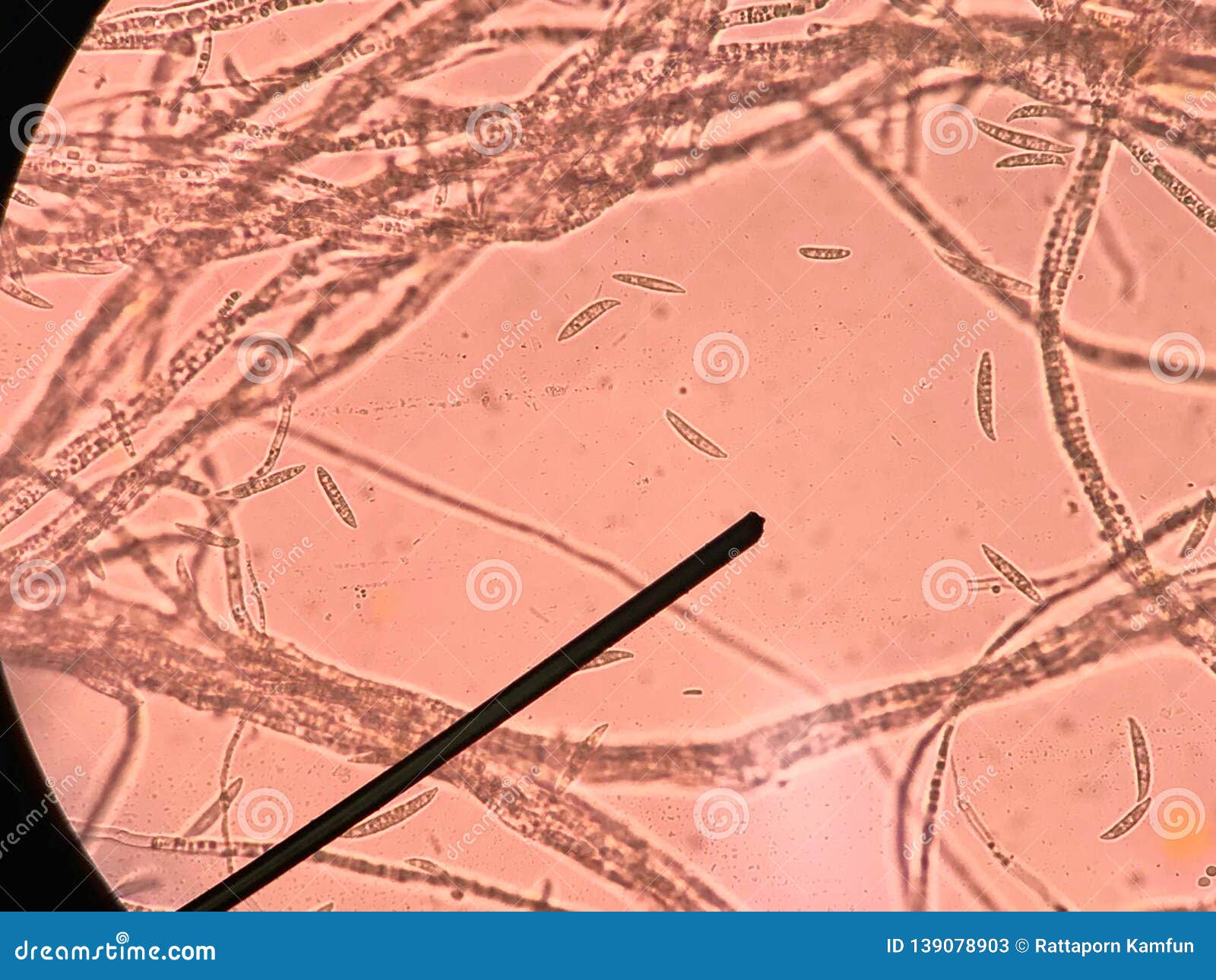 Fusarium Sp. Pathogen of Rice Stock Image - Image of ricedisease ...