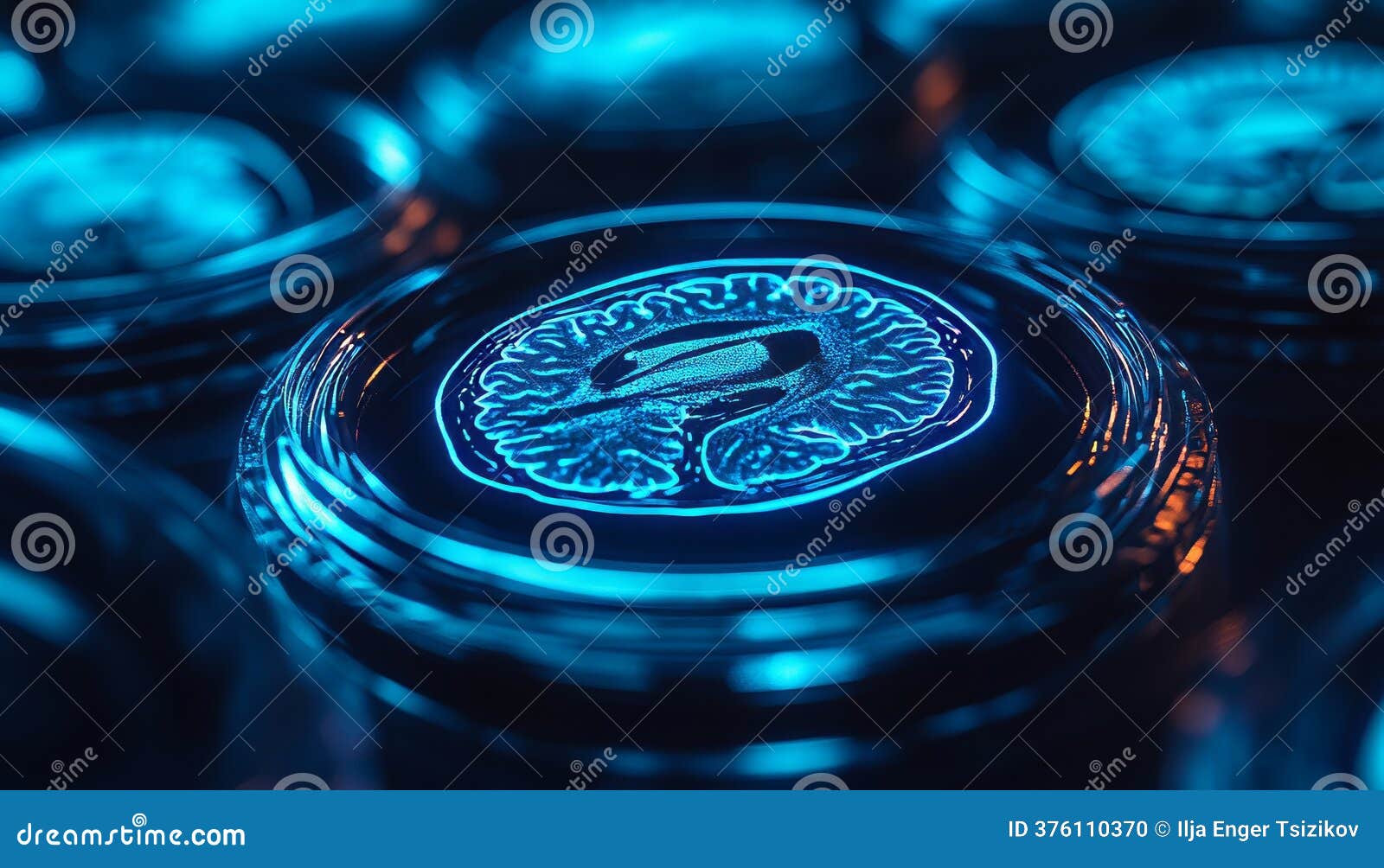 Exploring The Brain S Neural Connections Understanding The Complex ...