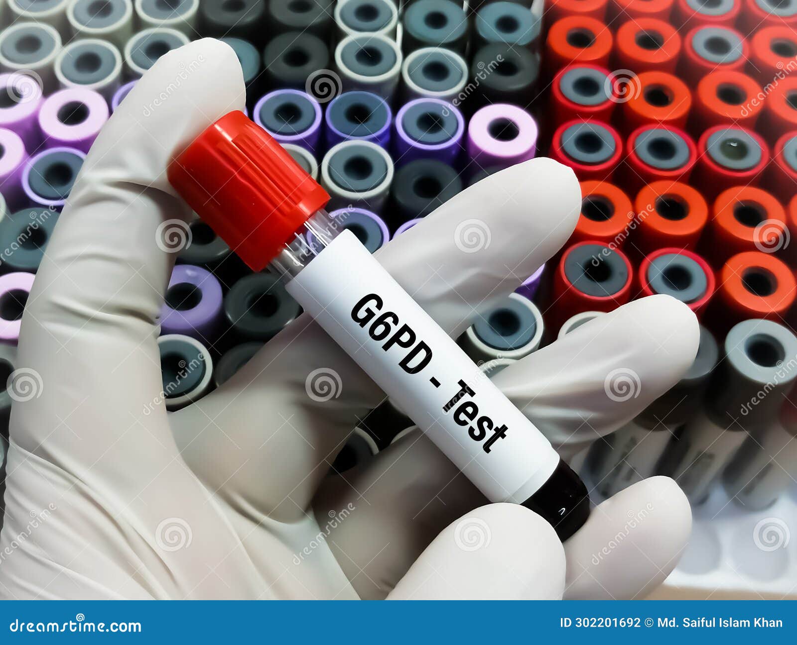 G6PD (glucose 6 Phosphate Dehydrogenase) Test Stock Photo - Image of ...