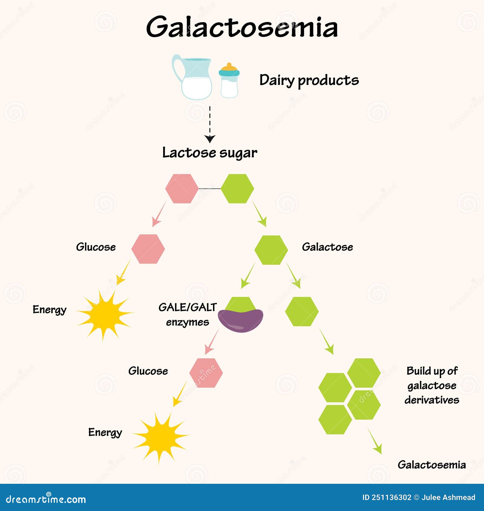 Galactosemia Vector Illustration Diagram Stock Vector - Illustration of ...