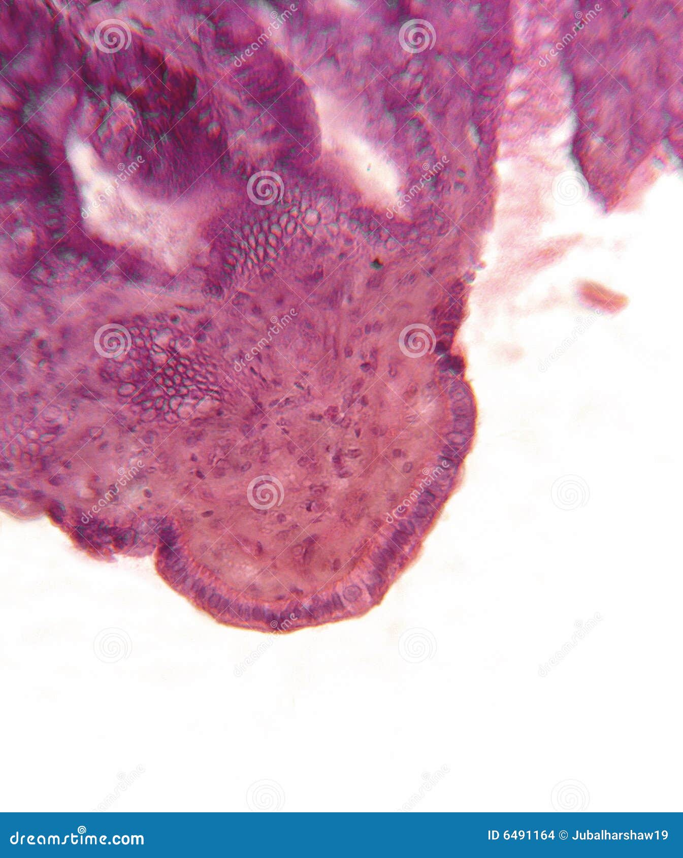 Bladder Slide Labeled