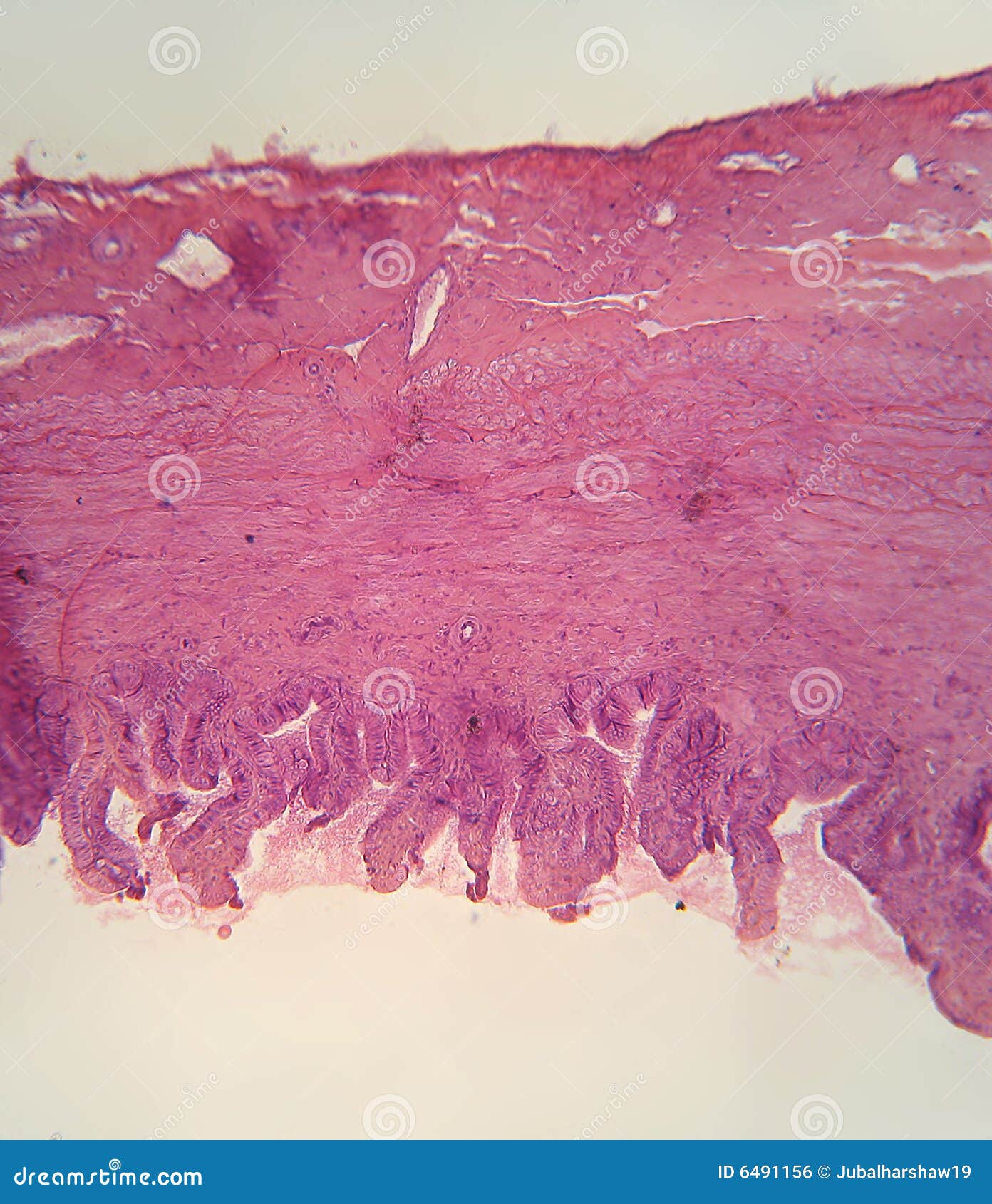 Gall Bladder, Microscopic Cross Section Stock Photo - Image of lamina ...