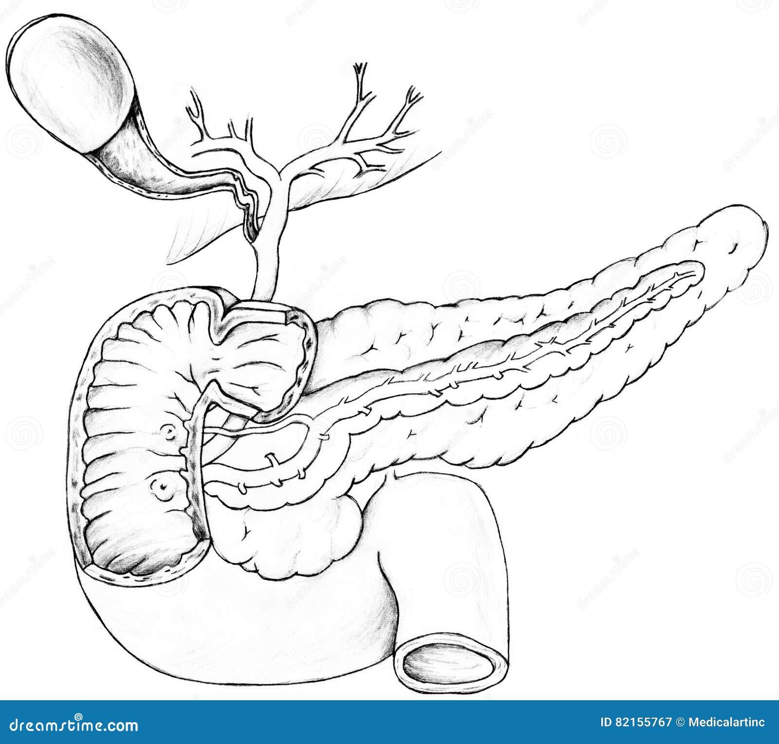 Gall Bladder, Páncreas Y Duodeno Stock de ilustración - Ilustración de ...