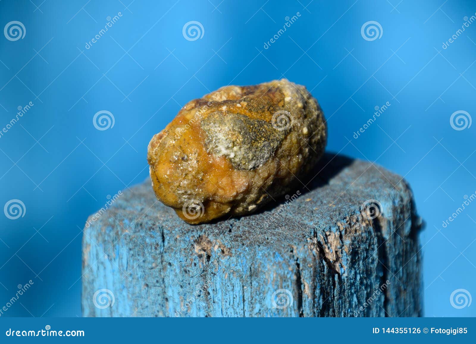 Gall Bladder Stone. Calculus of Heterogeneous Composition Stock Photo ...