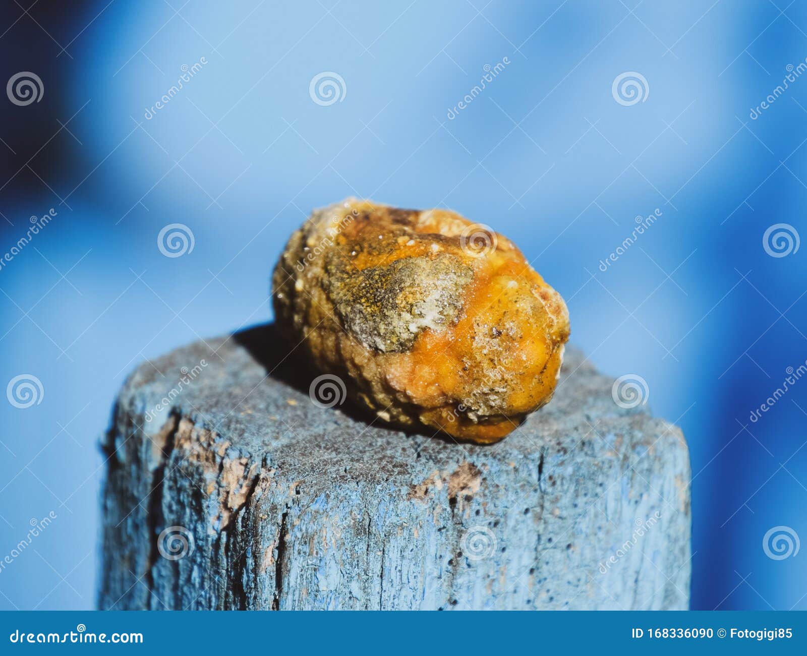 Gall Bladder Stone. Calculus of Heterogeneous Composition Stock Photo ...