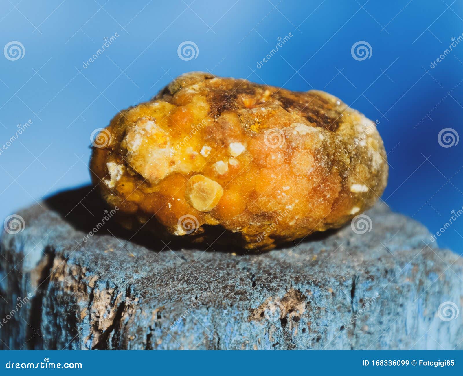 Gall Bladder Stone. Calculus of Heterogeneous Composition Stock Image ...