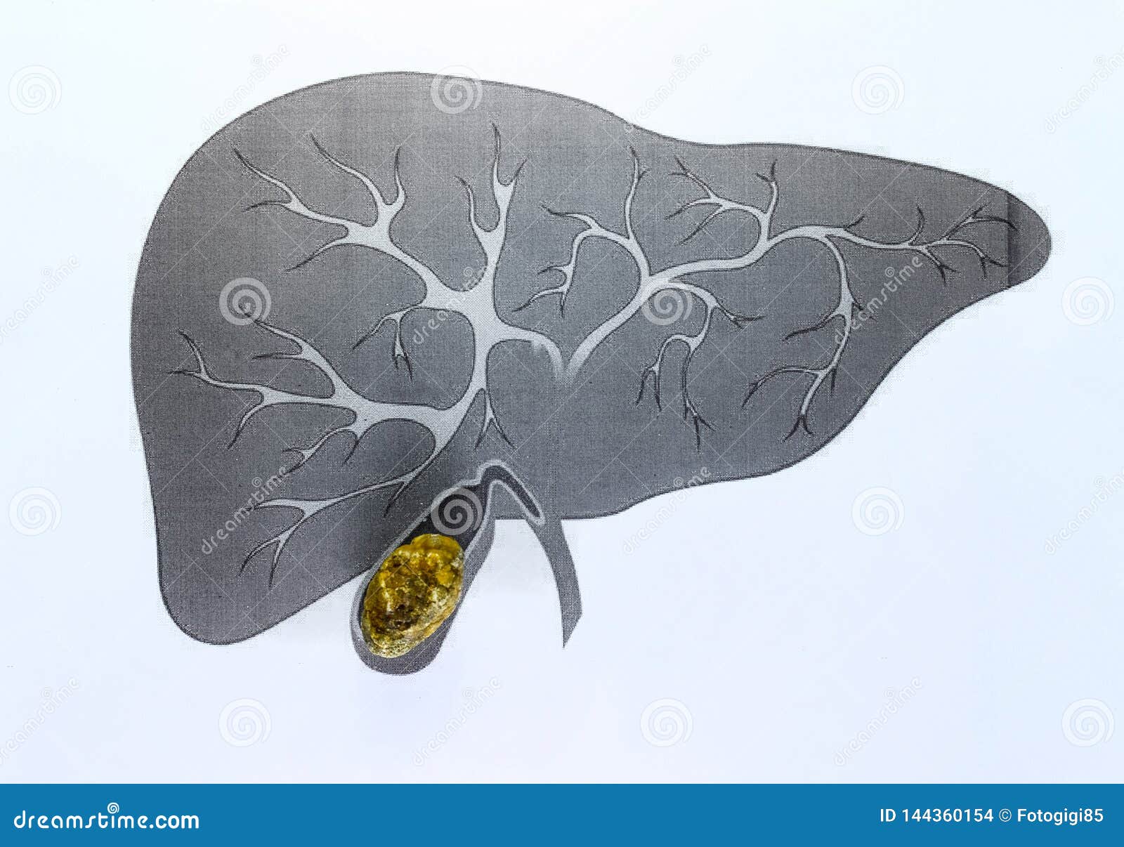 Gall Bladder, Microscopic Cross Section Stock Photography ...