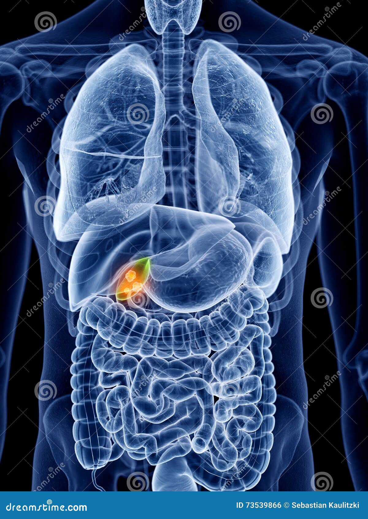 Gallbladder Cancer Banner. Symptoms, Treatment. Vector Signs For Web ...