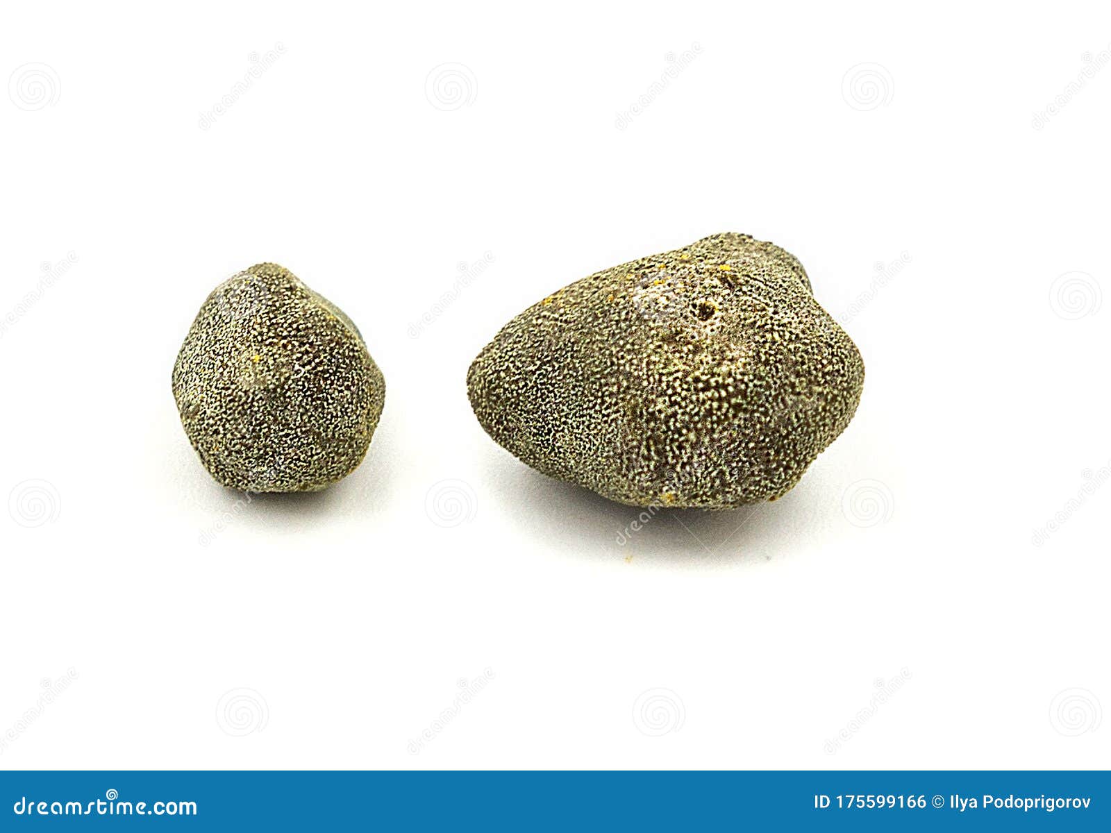 Gallbladder Stones on White Background Stock Photo - Image of disease ...