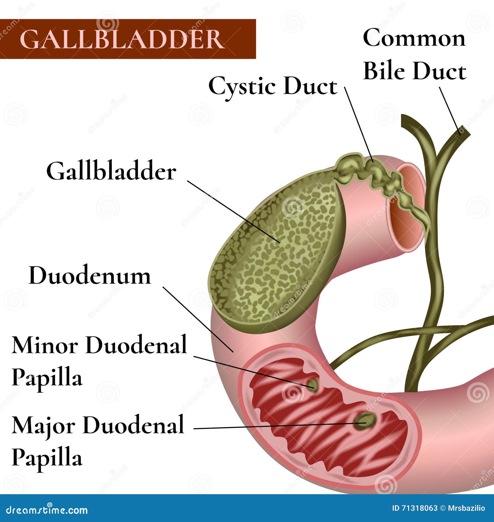 Gallbladder Vresighet - Kanal Vektor Illustrationer - Illustration av ...