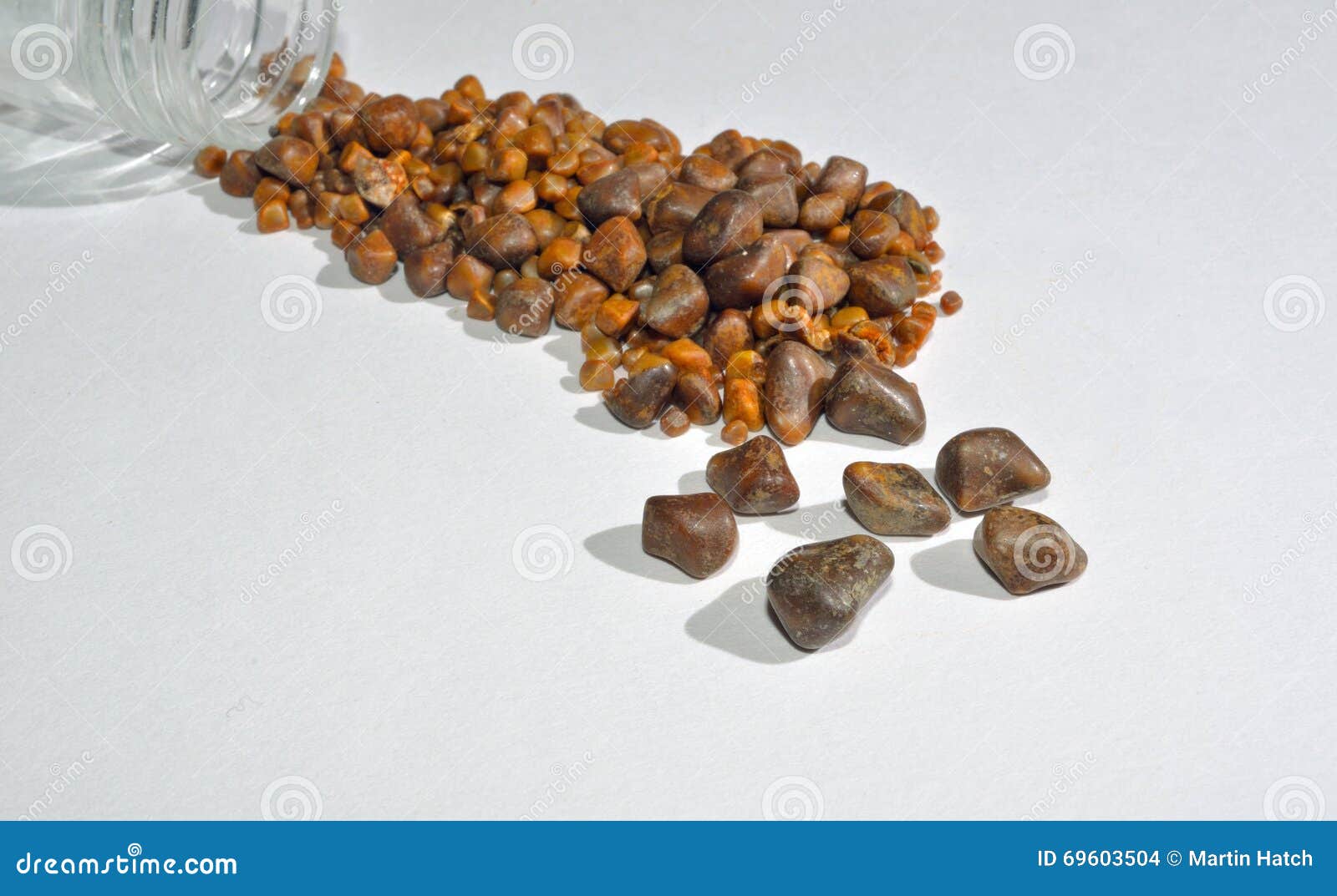 Gallensteine Von Der Einzelnen Operation Stockfoto - Bild von leber ...