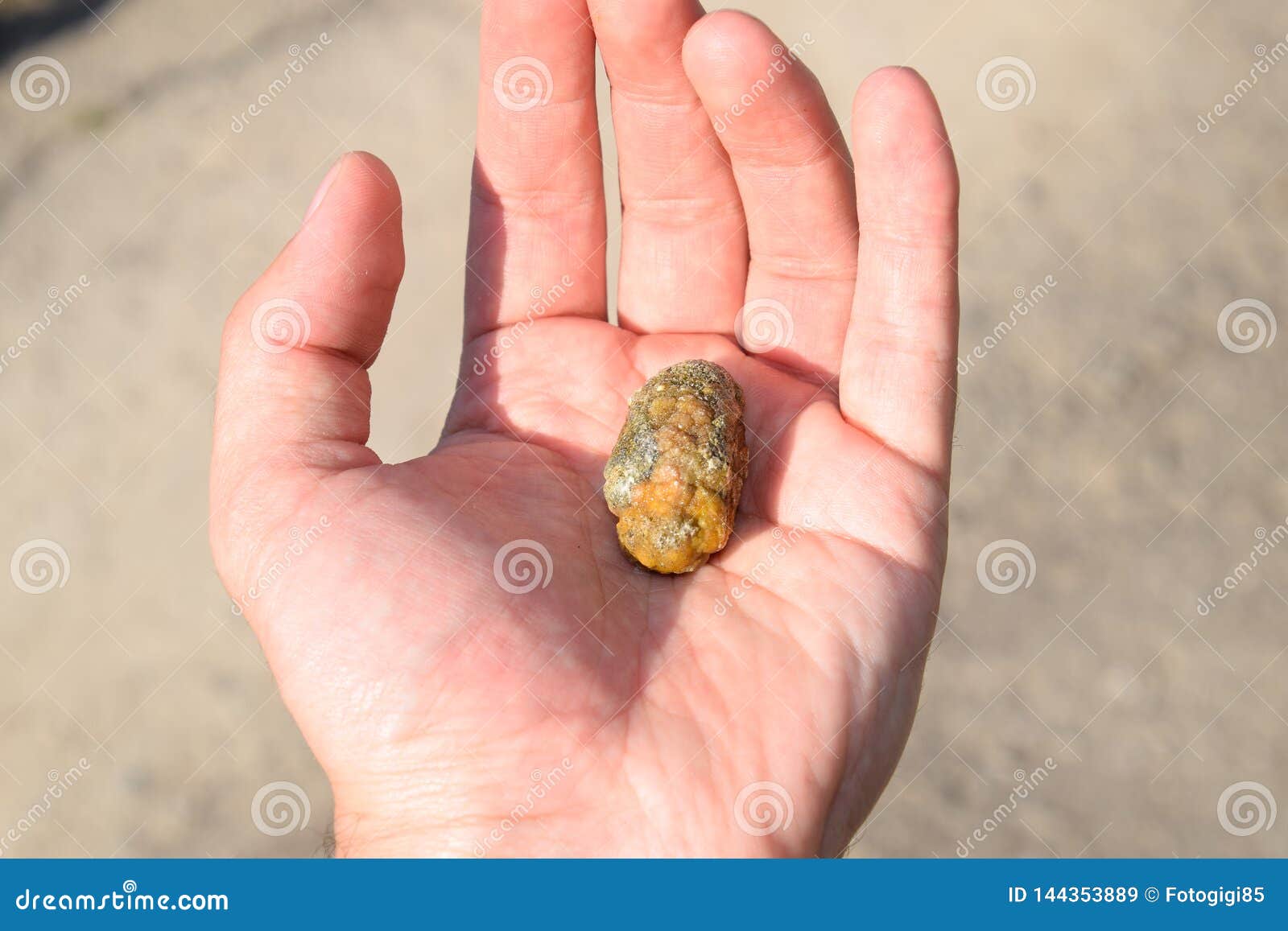 Gallstone in Hand, Gall Bladder Stone. Result of Gallstones. Calculus ...
