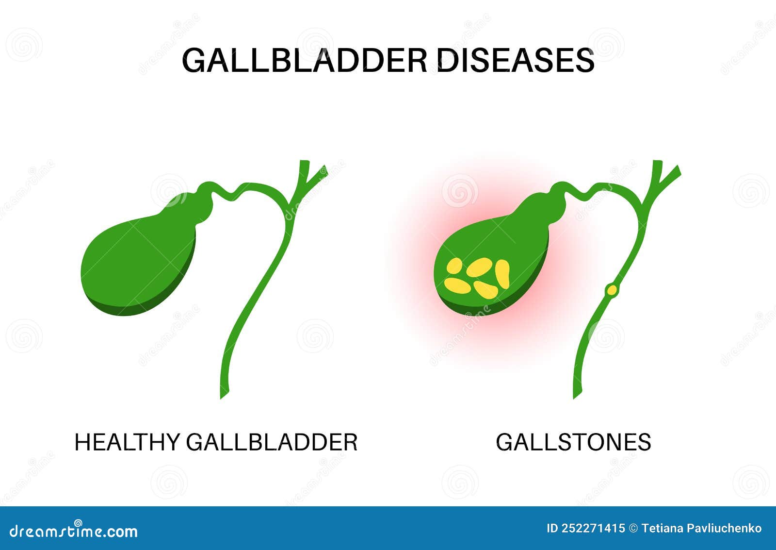 Gallbladder Anatomy Poster Cartoon Vector 252271415