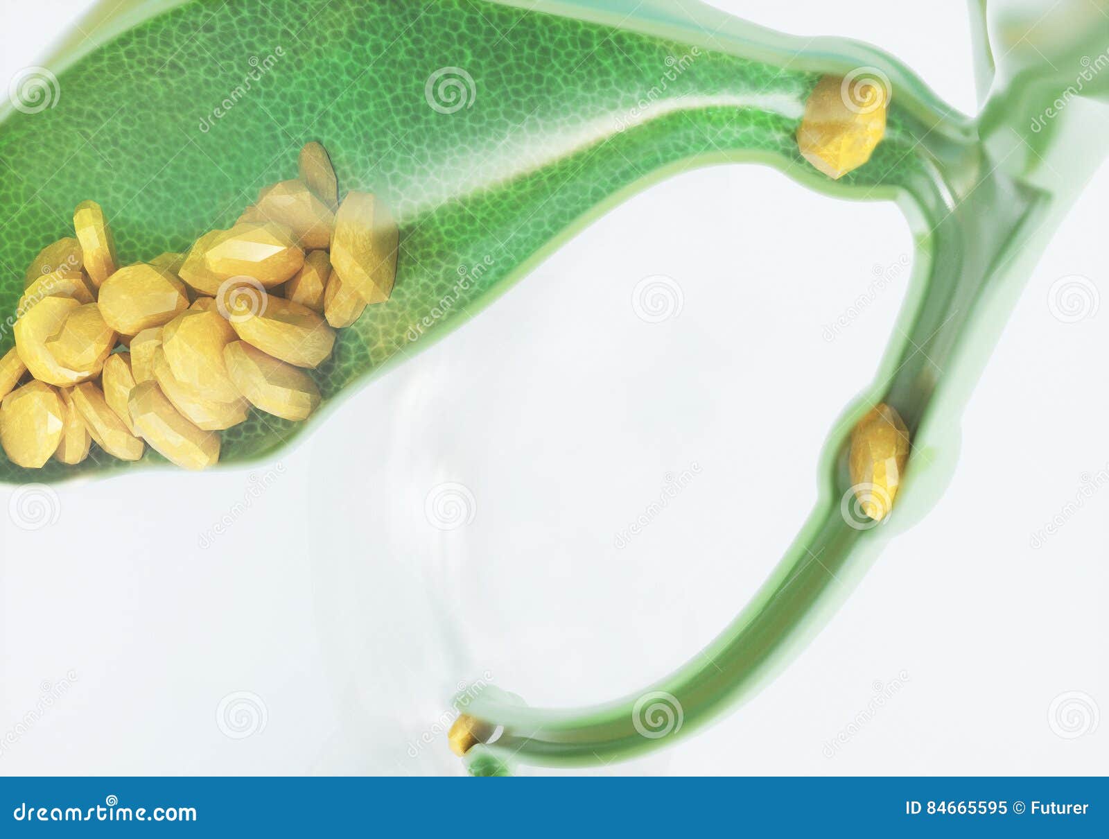 Gallstones - 3D rendering stock illustration. Illustration of ...