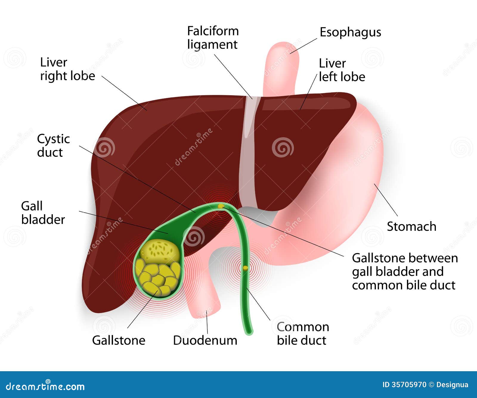 Galstenen vector illustratie. Illustration of lichaam - 35705970
